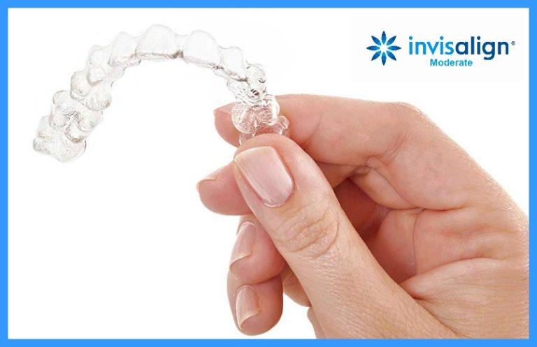 Invisalign Treatment in Canberra | Dentist Canberra